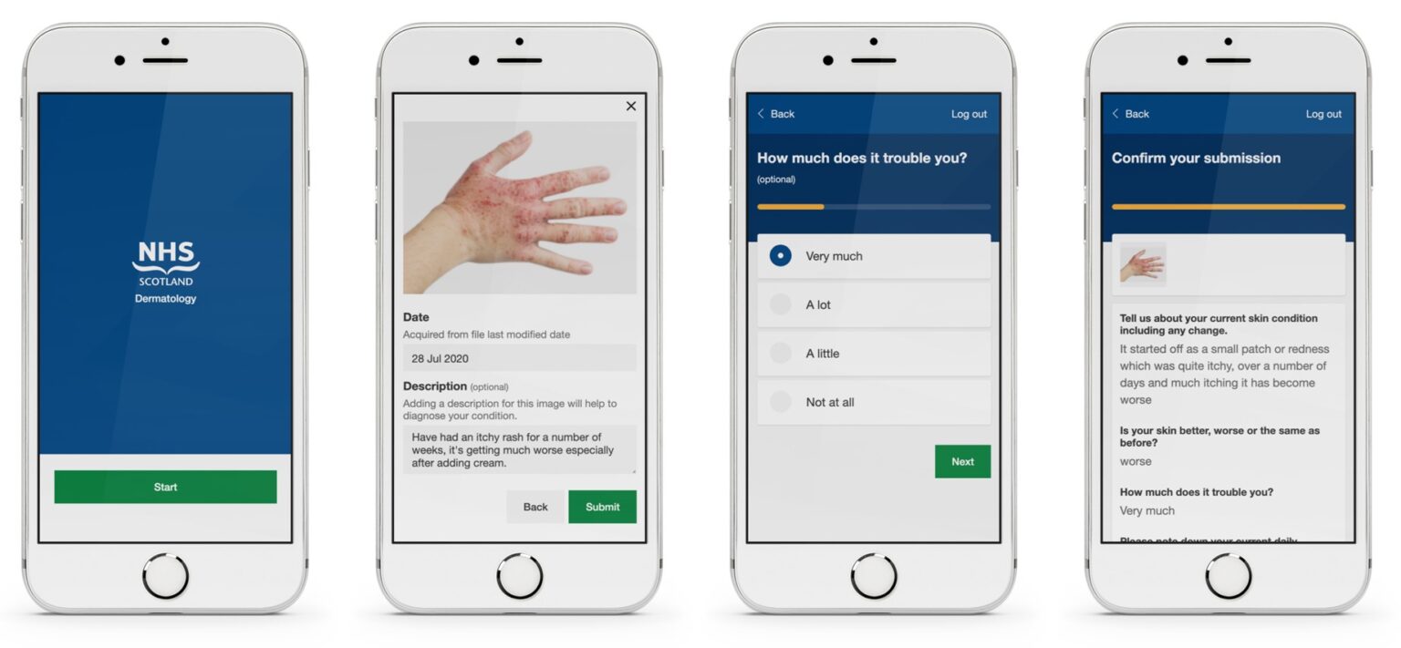 New expert dermatology service offered to local patients - NHS Western ...